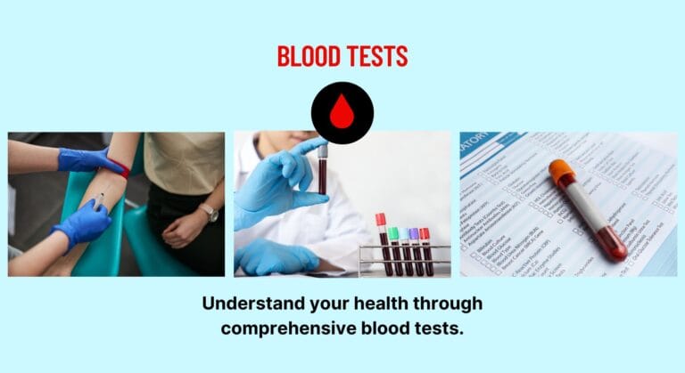 List of 150 Medical Tests With Short Introduction